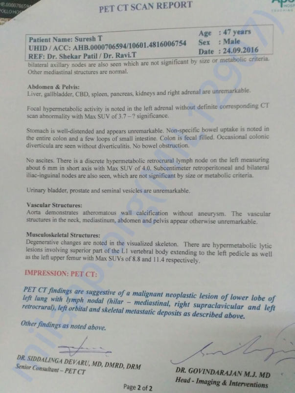 Help Suresh in his Fight Against CANCER | Milaap