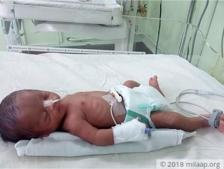 This 4-Month-Old Baby Throws Up At Least 8 Times A Day And Is Half The ...