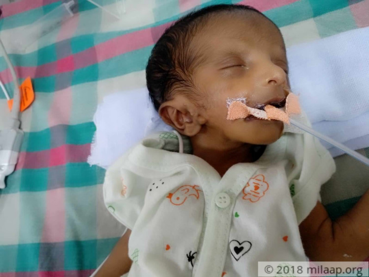 This Newborn Baby Has Abnormal Flow Of Blood, He Will Lose | Milaap