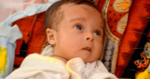 This 4-Month-Old Baby Throws Up At Least 8 Times A Day And Is Half The ...