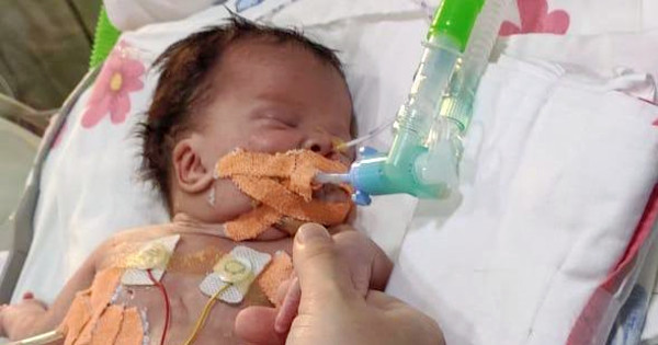 26 Days Old Baby Needs Your Help Fight Hydrops with chylothorax | Milaap