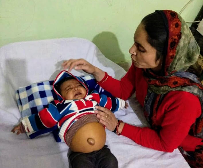 Help This 6-Month-Old Baby Girl Whose Belly Is Bloating Every | Milaap
