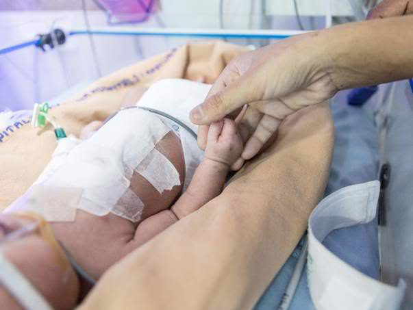 This 6-Day-Old Was Born With Her Intestines On The Outside | Milaap