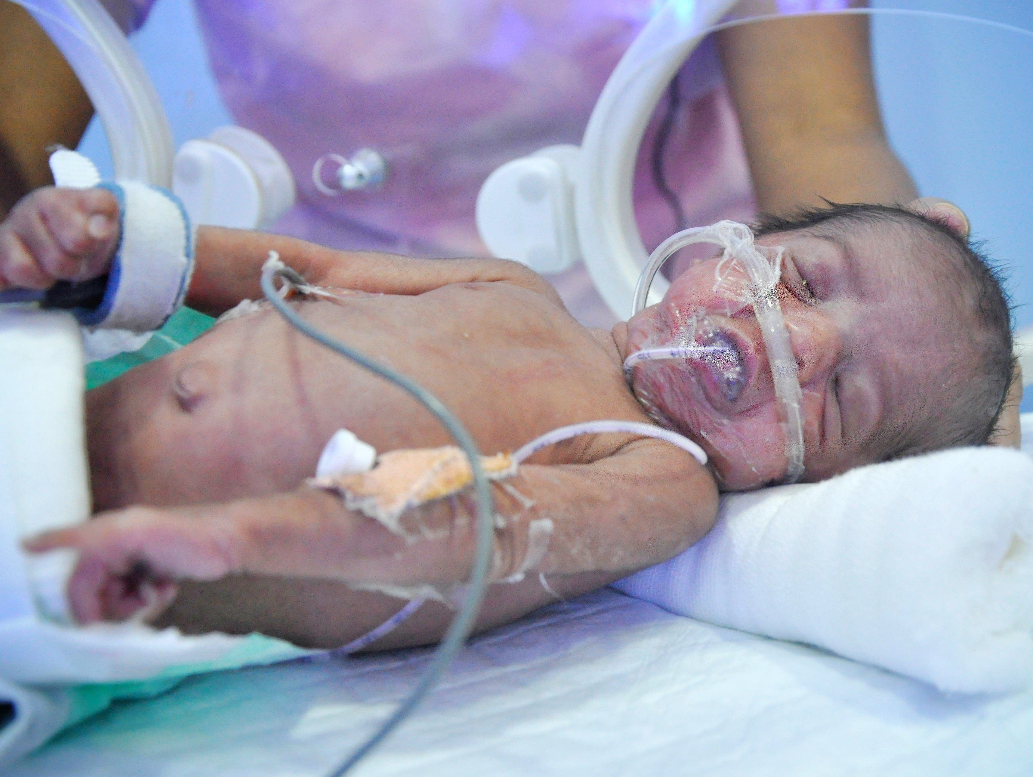 Barber Who Has Not Held His Infant Daughter Even Once Appeals | Milaap